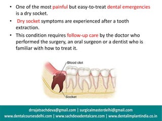 Dry socket | PPTX