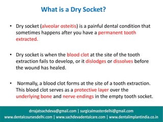 Dry socket | PPT