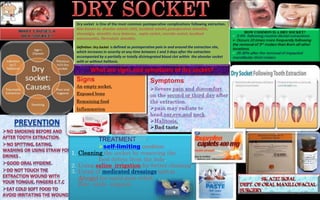 Dry socket | PPTX