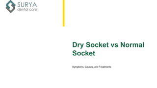 Dry Socket vs Normal Socket - Surya Dental Care | PPTX