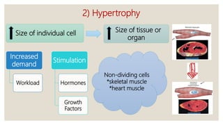 Cellular Adaptation | PPTX