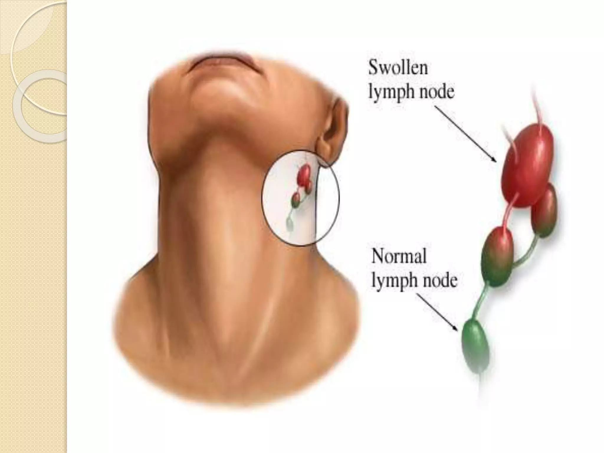 General Organization of the Lymph Nodes and Lymphatics | PPTX