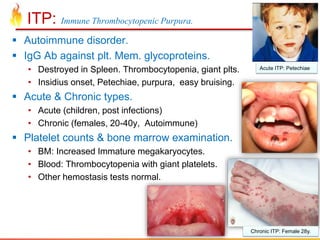 Haematology for Dental Students - Bleeding Disorders | PPTX