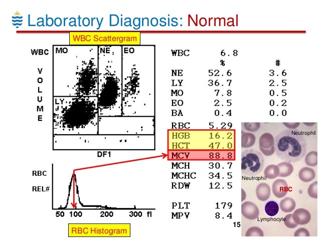 Haematology for Dental Students - RBC Disorders