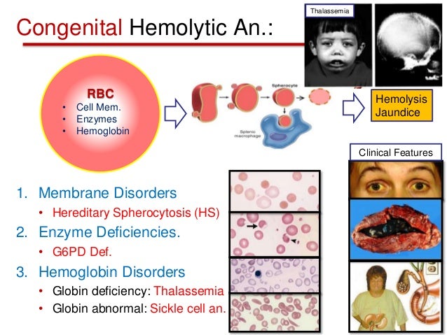 Haematology for Dental Students - RBC Disorders