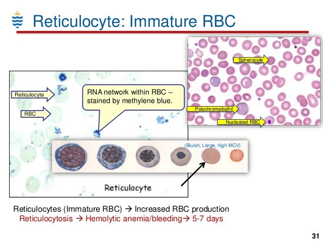 Haematology for Dental Students - RBC Disorders