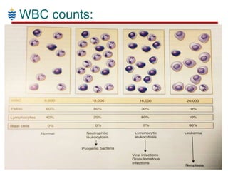 Haematology for Dental Students - WBC Disorders | PPT