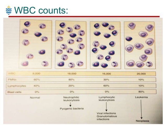 Haematology for Dental Students - WBC Disorders | PPTX | Blood ...