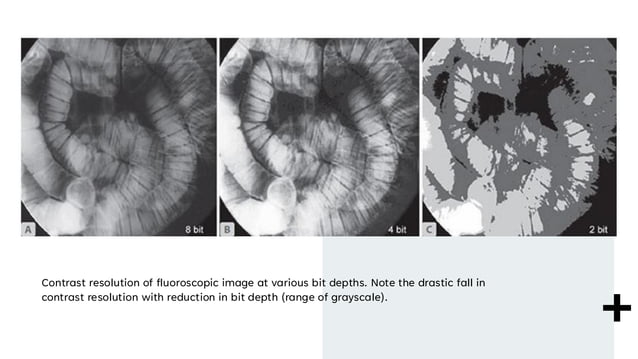 Digital subtraction angiography ppt for radio | PPT