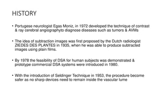 DSA.pptx Recent advances in digital subtraction angiography | PPTX