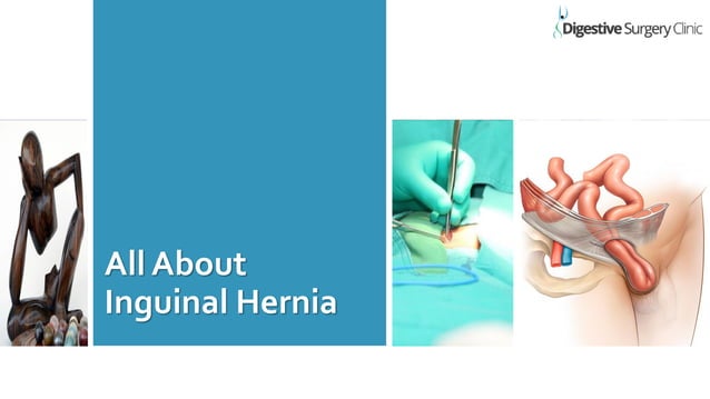All about Inguinal Hernia | PPT