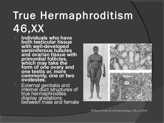 DISORDERS OF SEXUAL DEVELOPMENT