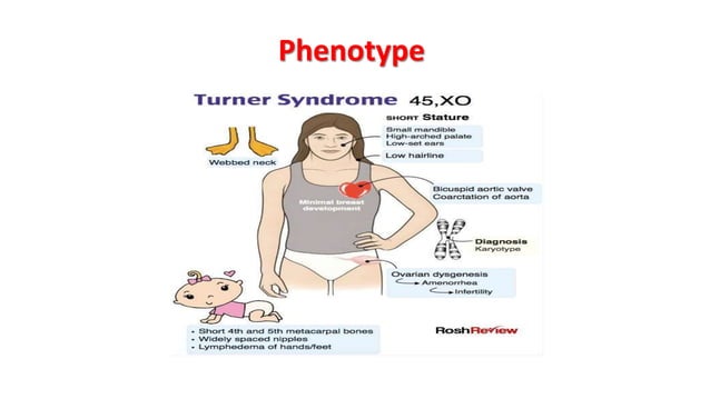 DSD (Disorders of sexual development), Intersex.pptx | Hormonal ...