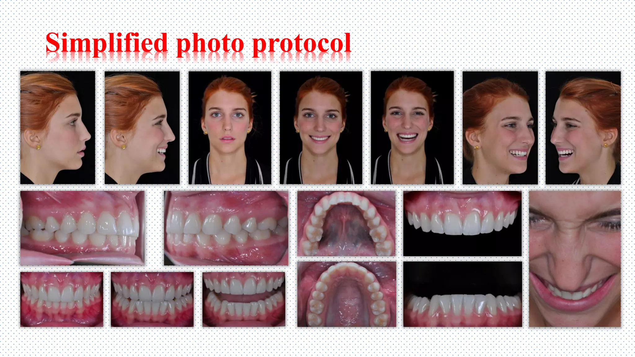 DSD -Digital Smile Desgin. | PDF