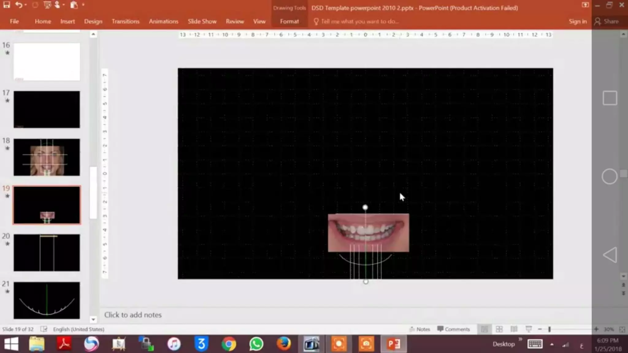 DSD -Digital Smile Desgin. | PDF