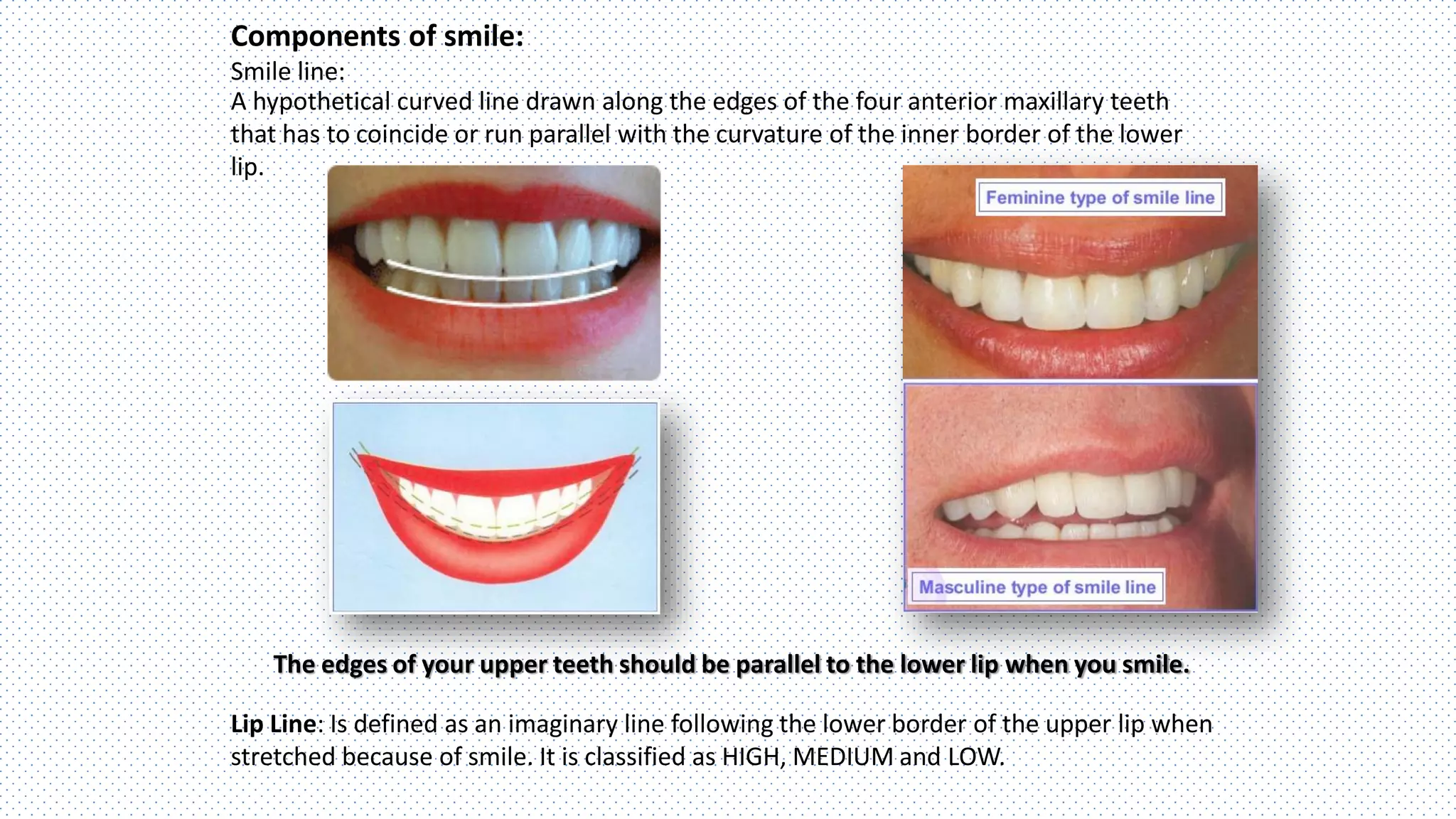 DSD -Digital Smile Desgin. | PDF
