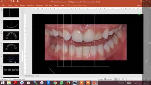 DSD -Digital Smile Desgin. | PPT