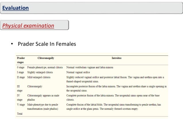 Disorders Of Sexual Differentiation