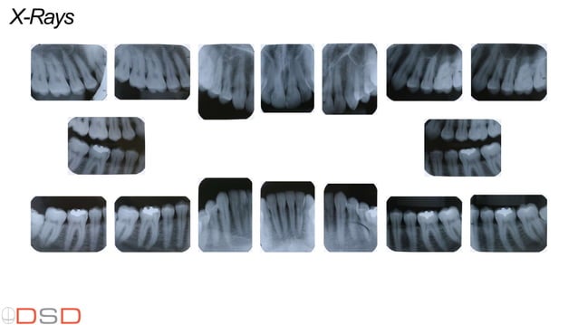 DSD Template powerpoint 2010.pptx