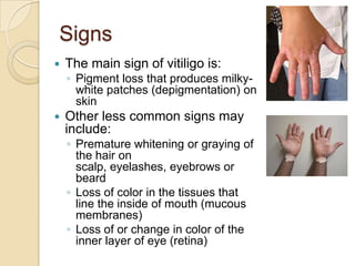 Dse of the epithelium by dr.shumayla aslam | PPTX