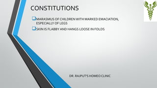 abrotanum is a medicine for merismus who | PDF