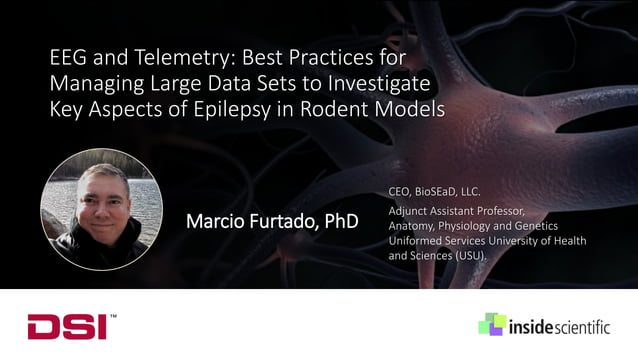 EEG and Telemetry: Best Practices for Managing Large Data Sets to ...