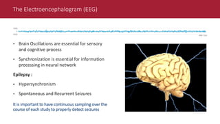 EEG and Telemetry: Best Practices for Managing Large Data Sets to ...
