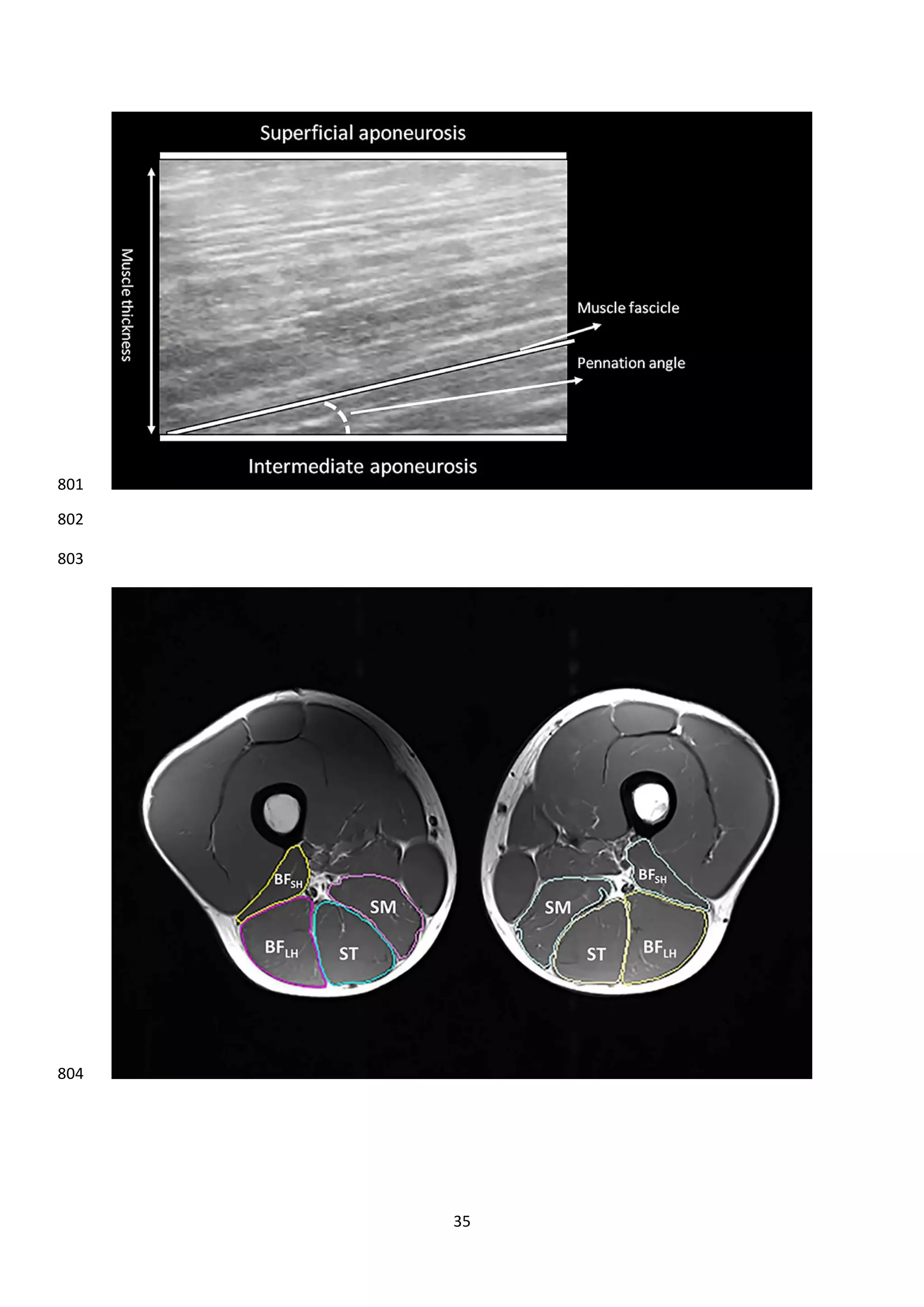 Impact of the Nordic hamstring and hip extension exercises on hamstring ...