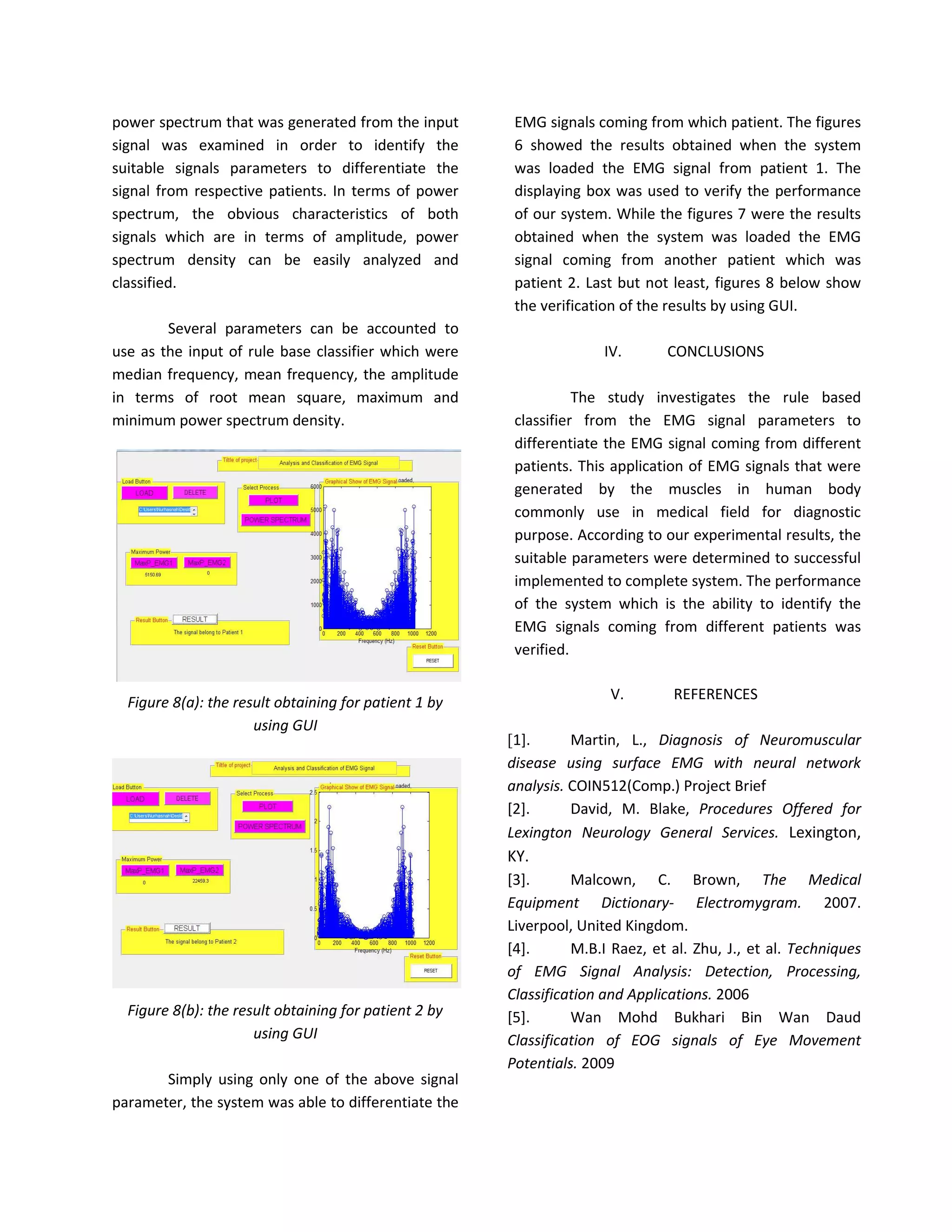 Dsp lab report- Analysis and classification of EMG signal using MATLAB ...