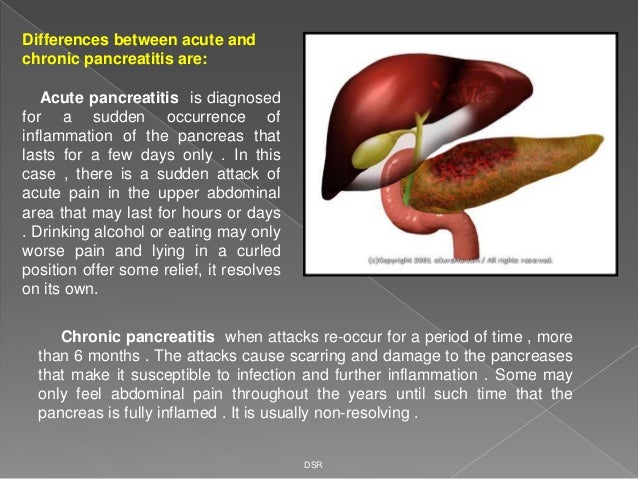 ENZYMATIC STUDY IN ACUTE AND CHRONIC PANCREATITIS.