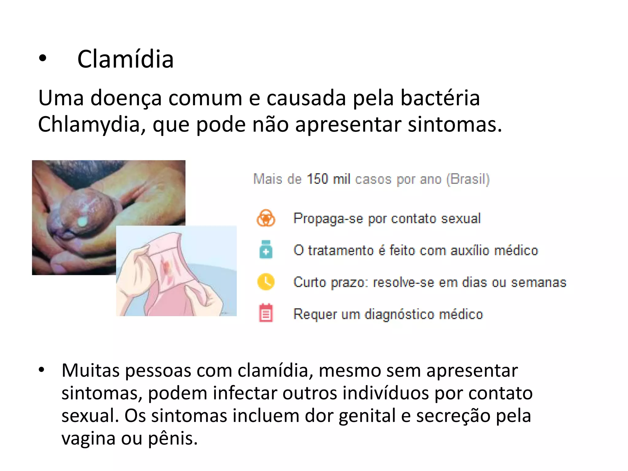 DST / IST - Infecções Sexualmente Transmissíves | PPTX