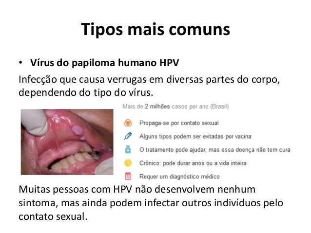 DST / IST - Infecções Sexualmente Transmissíves