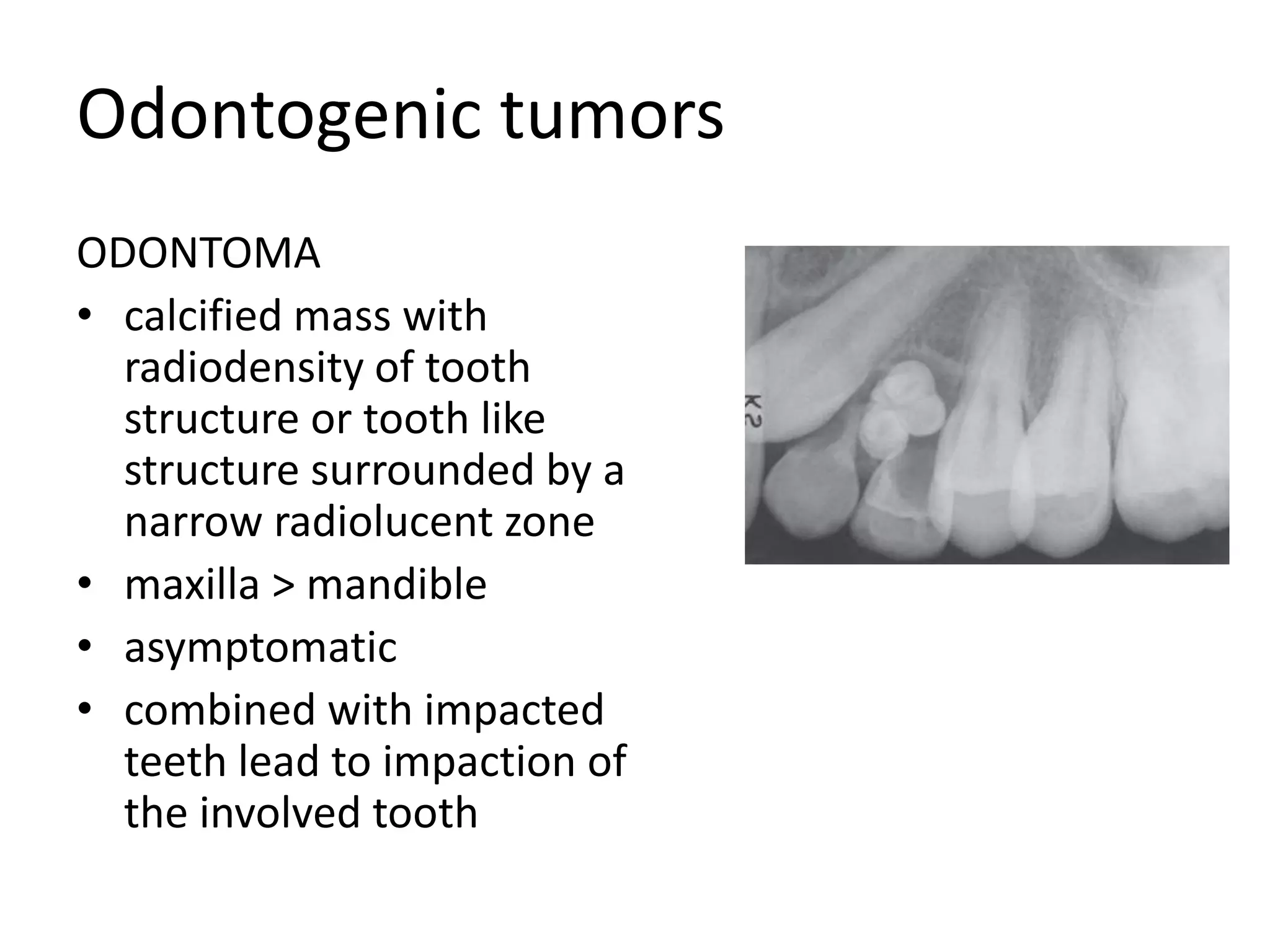 delay tooth eruption | PPTX