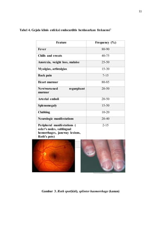 Dt endokarditis infektif | DOCX
