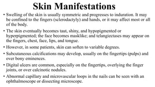 Scleroderma - Dhara | PPT