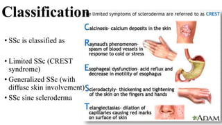 Scleroderma - Dhara | PPT