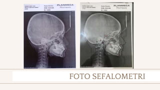 DTM ORTHO TYPODONT LIZAaaa saaaaave.pptx