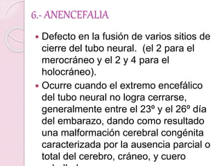 Defectos del Tubo Neural - Embriología | PPTX