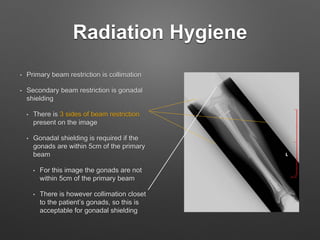 D torres lower_leg_oralppt3 | PPTX