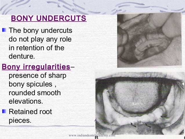 Diagnosis and treatment planning in completely endntulous arches/dent…