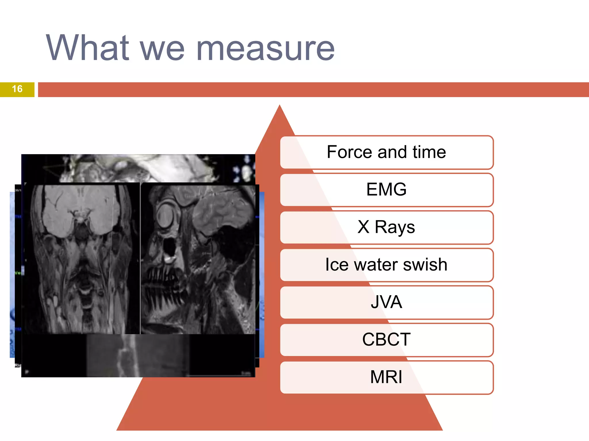 DISCLUSION TIME REDUCTION AND TSCAN APPLICATION | PPTX