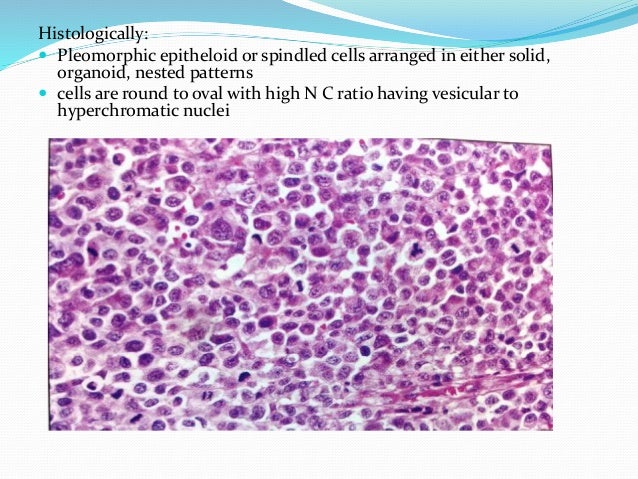 Tumors And Tumor Like Conditions Of Nasal Cavity