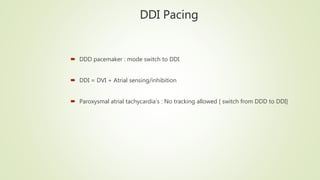 PM Dual chamber mode | PPT