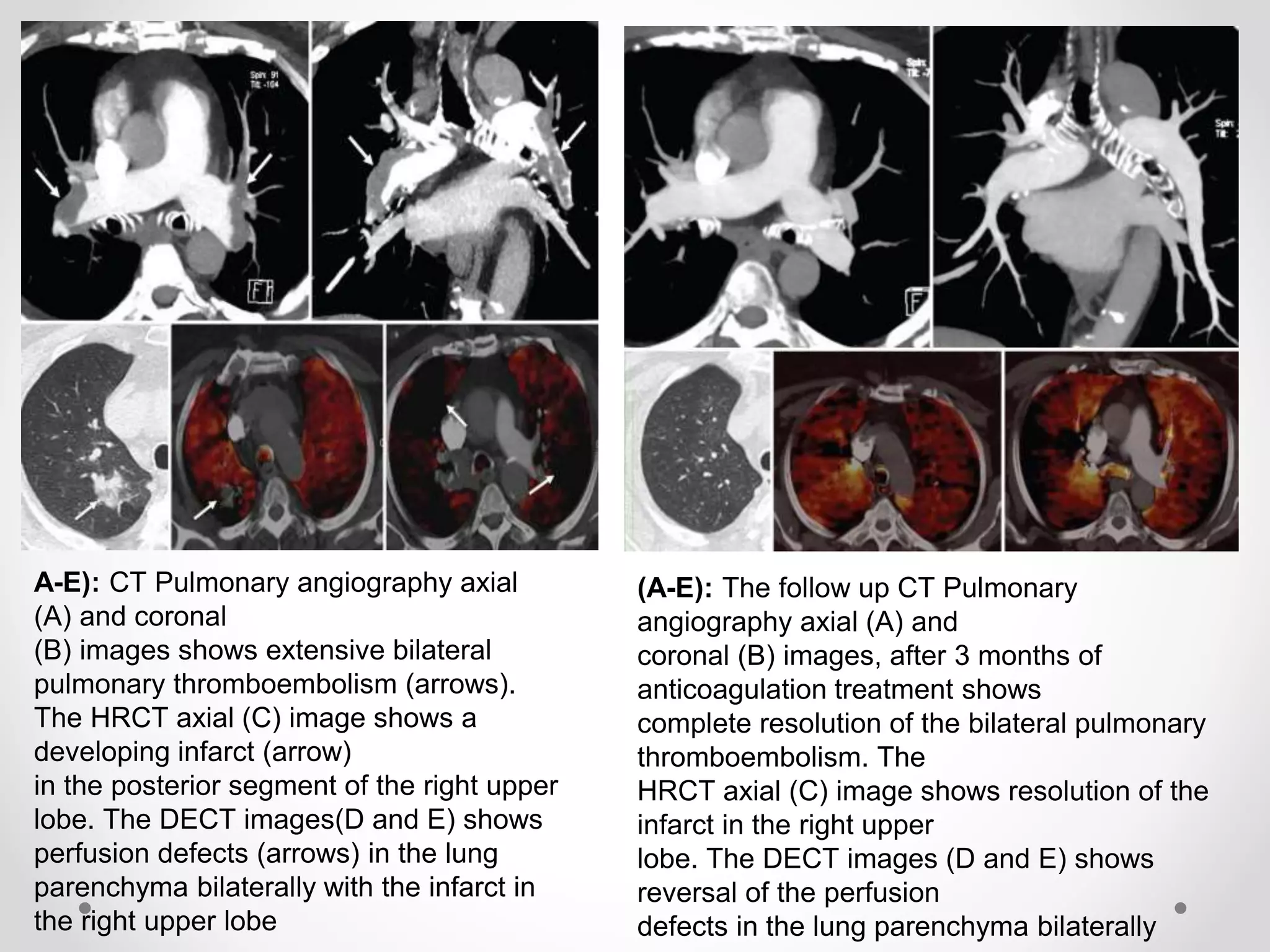 DUAL ENERGY CT-1.pptx