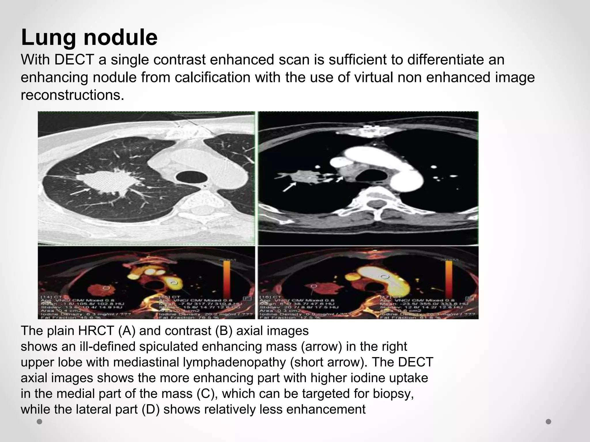 DUAL ENERGY CT-1.pptx