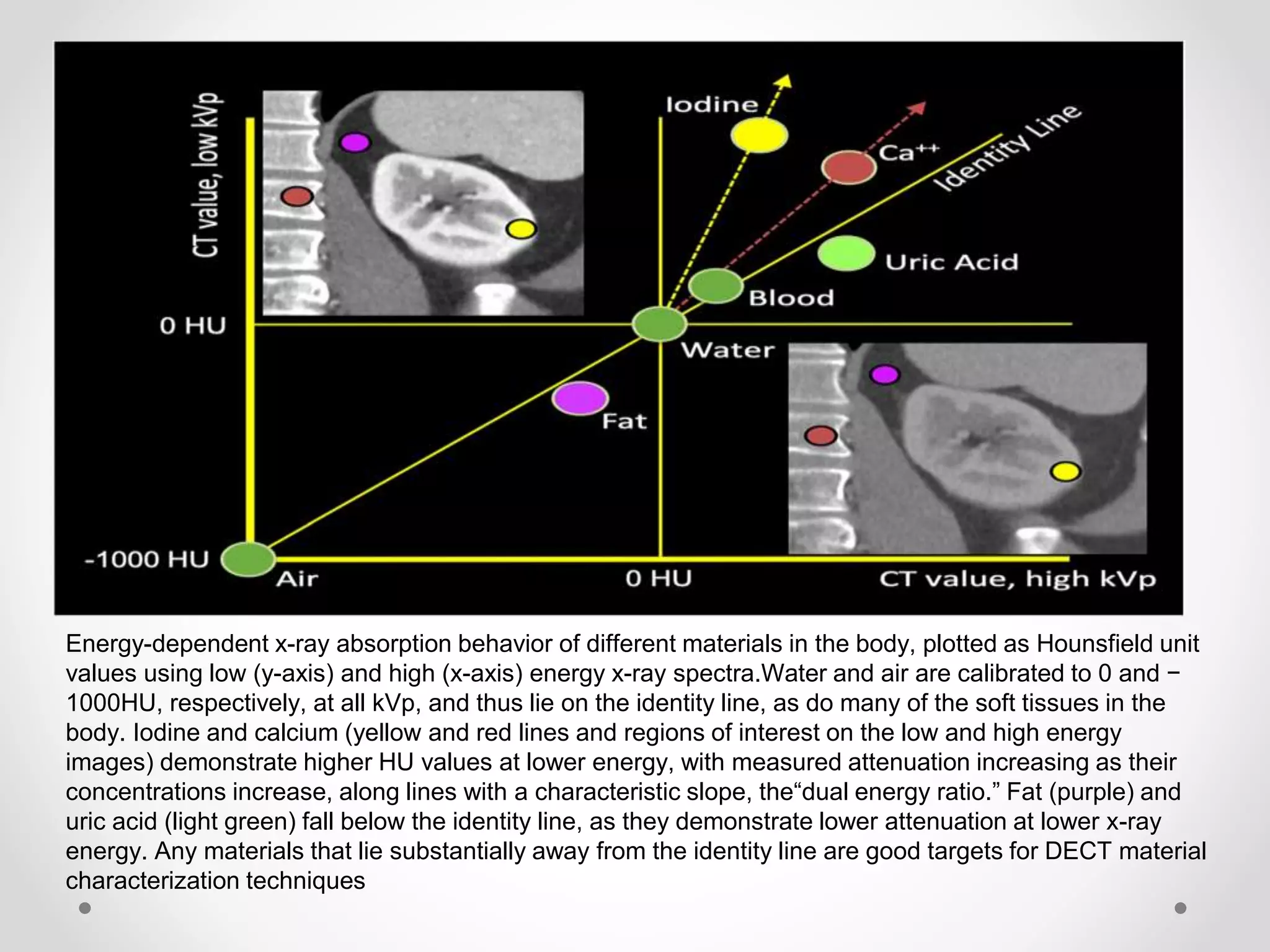 DUAL ENERGY CT-1.pptx
