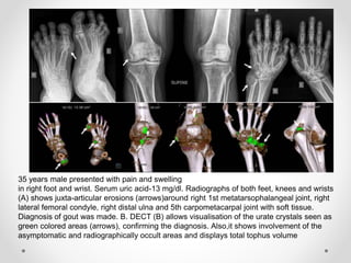 DUAL ENERGY CT-1.pptx