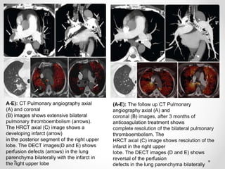 DUAL ENERGY CT-1.pptx