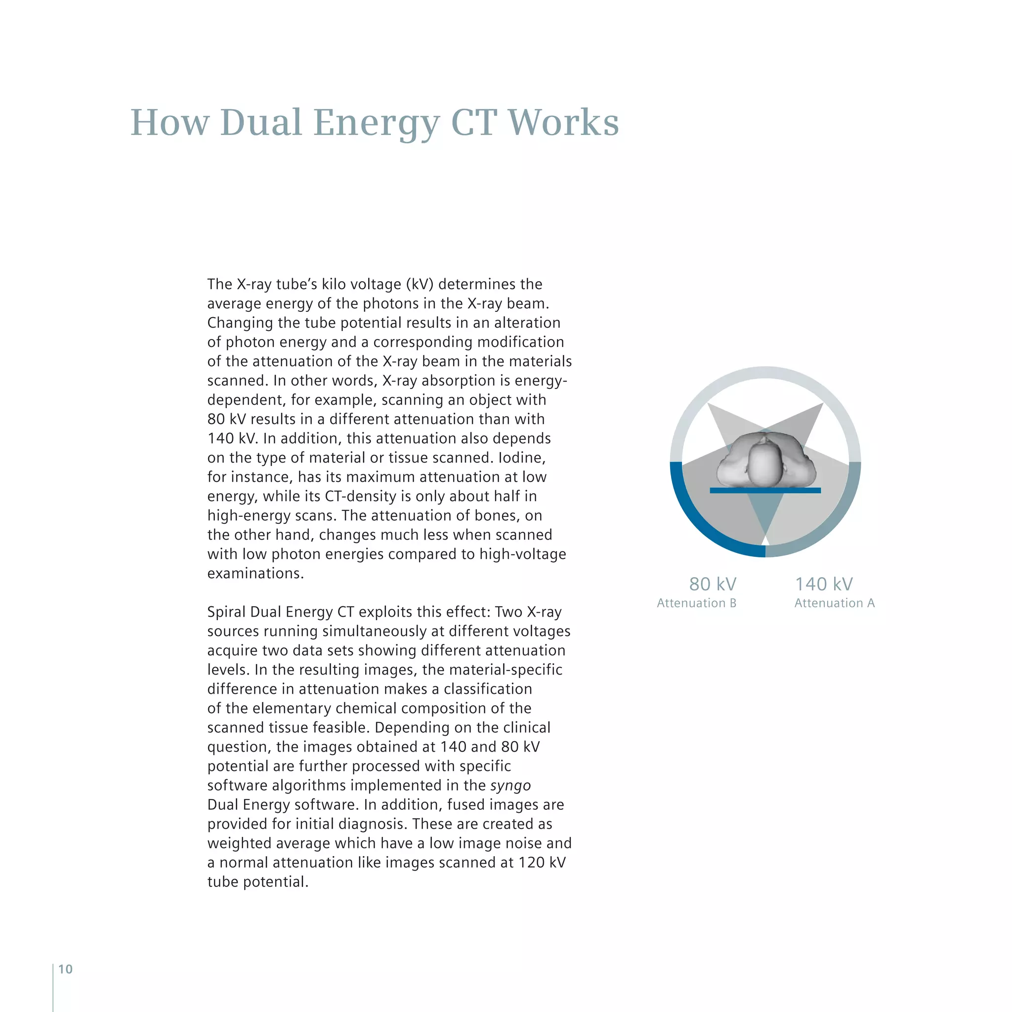 Dual Energy CT - SIEMENS | PDF