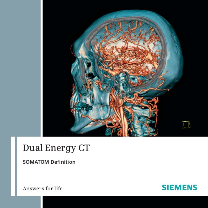 Dual Energy CT - SIEMENS